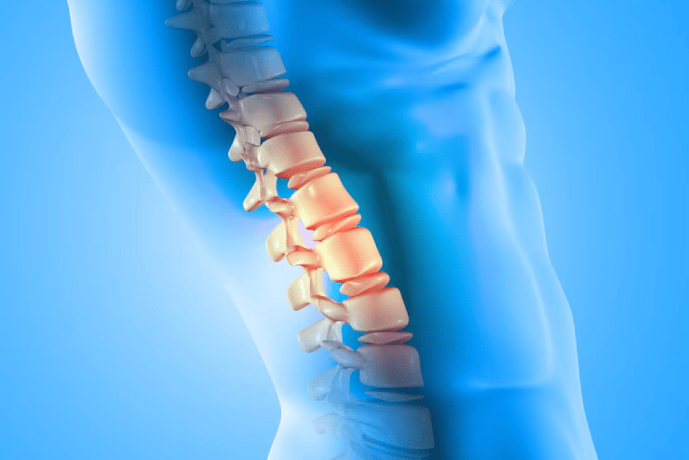 Lumbar spinal Instability - Ishaan Ortho and Spine Clinic Bangalore