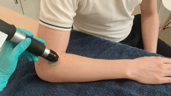Therapeutic injections into joints, inflamed arms like Tennis elbow ...